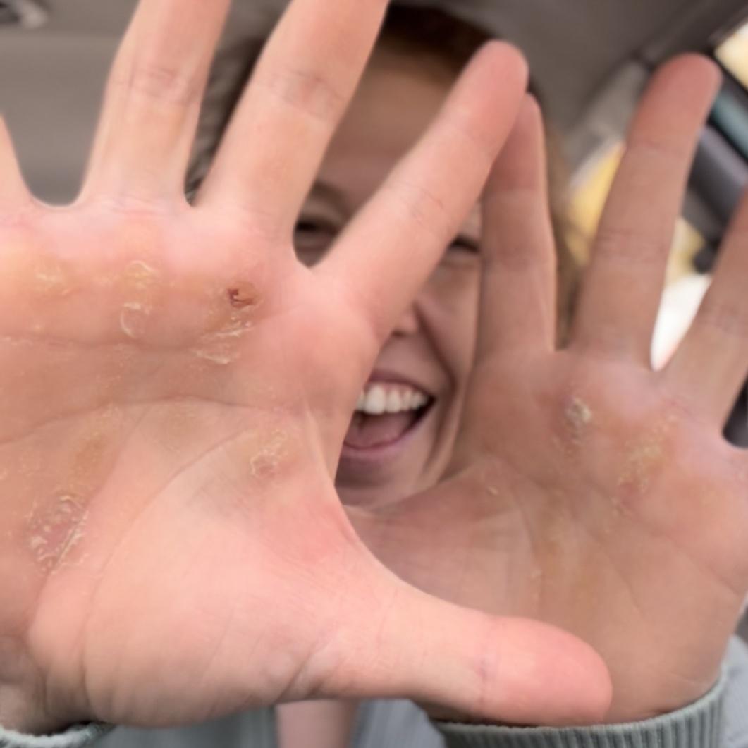 Callus & Rip Care 101 by Jess St John